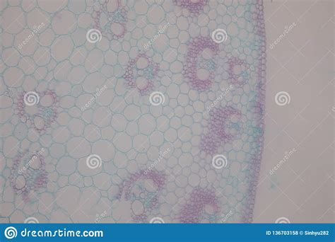 Monocot Stem Under Microscope