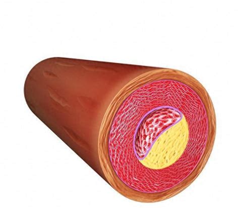 不想血压越来越高，这几种水果或要少吃，为了健康建议重视