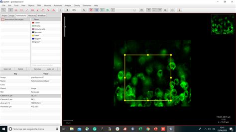 How To Cut Square In Size 160x160 From A Bigger Image In Qupath Image
