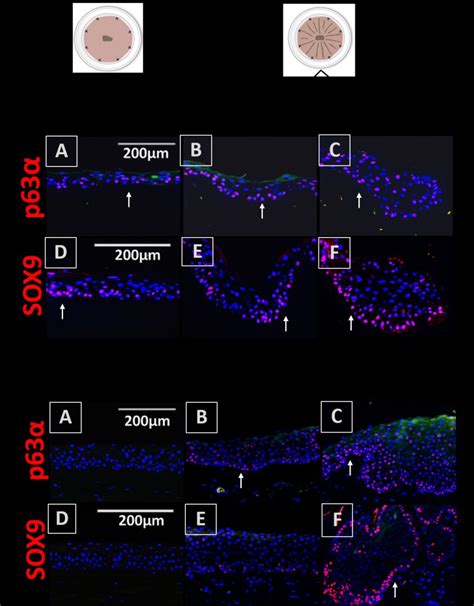 Progenitor Marker Distribution In Situ In Human Epithelial Download Scientific Diagram