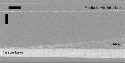 B Mode Scan Of A Tissue Sheet With Mold Using The OCT Device Download Scientific Diagram