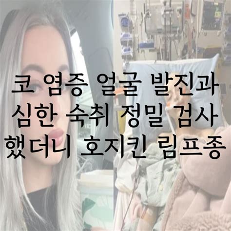 코 염증 얼굴 발진과 심한 숙취 정밀 검사했더니 호지킨 림프종 네이버 블로그