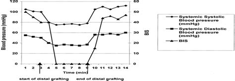 Bispectral Index As An Indicator Of Cerebral Hypoperfusion D Anesthesia And Analgesia