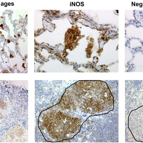 Inducible Nitric Oxide Synthase Inos Expression In Human Download Scientific Diagram