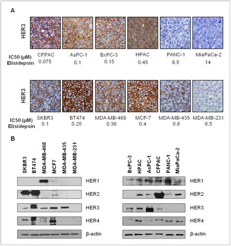 A Cell Pellets Were Fixed In Formalin Embedded In Paraffin And A Her3 Download Scientific