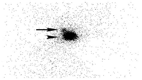 Sentinel Node Imaging Of Laryngeal Cancer Using A Portable G
