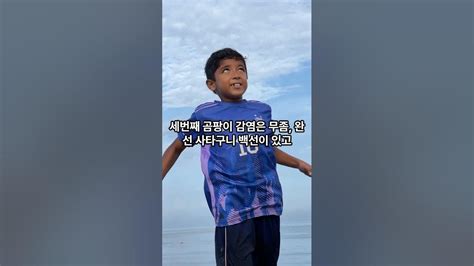 성인 여드름 ㅣ 턱과 입 주변으로 여드름이 생기는 이유와 치료방법 Youtube