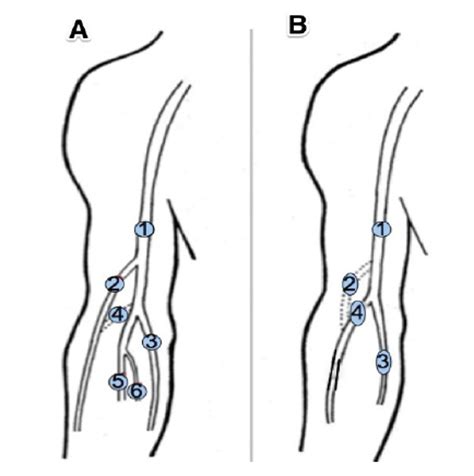 Schematic Diagram Of Development Of The Brachial Artery Showing The