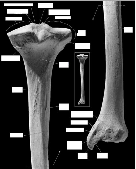 Tibia Right Posterior Diagram Quizlet