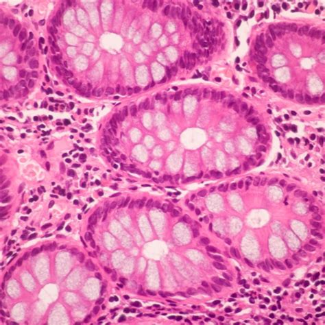 Liquid‐based Cytology And Cell Block Immunocytochemistry In Veterinary