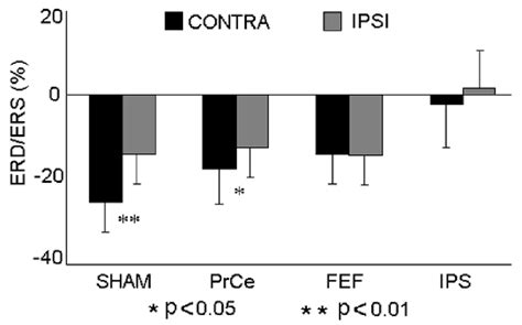 Contralateral Spatial Selectivity Of Alpha Power By Rtms Condition