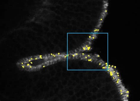 Example Of A Biologically Interesting Spatial Pattern Best Viewed In