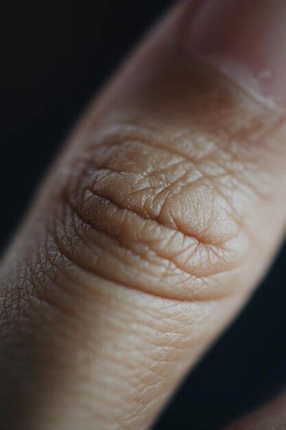 Premium Photo Close Up Of Cropped Thumb