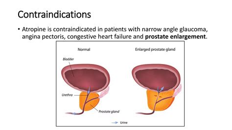 Parasympatholytics Pptx