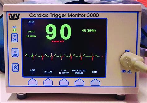 Front Panel Of A Trigger Cardiac Monitor Device Ivy Biomedical