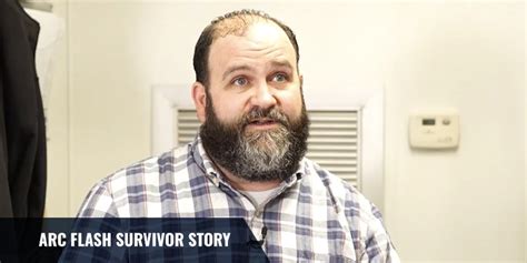 Arc Flash Survivor Story Epsco