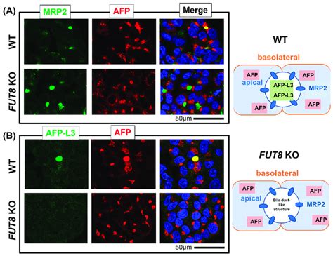 Localization Of Afp L3 Was Observed In The Bile Duct Like Structures In Download Scientific