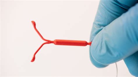 Langkah-langkah Pemasangan Alat Kontrasepsi IUD atau KB Spiral - KlikDokter