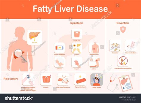 Vector Illustration Infographic Fatty Liver Disease Stock Vector