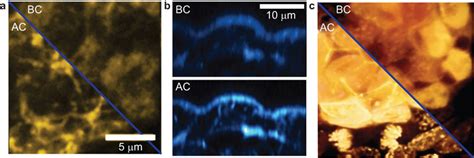Demonstrations Of Adaptive Aberration Correction In Multiphoton