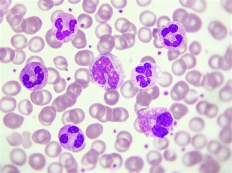 What Are Leukocytes Types Of Leukocytes
