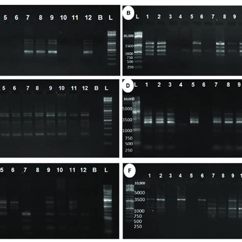 Random Amplified Polymorphic Dna Rapd Polymorphism In Download Scientific Diagram