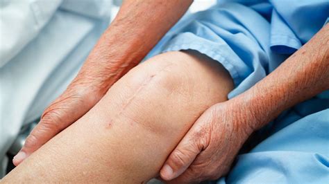 Top Disadvantages Of Knee Replacement Surgery Arthritis Knee Pain Centers