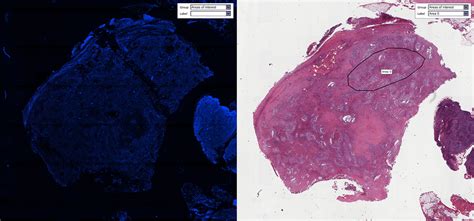 Home Applications Pathology Tissue Matching