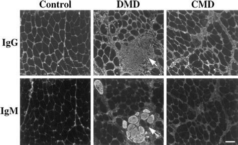 Immunohistochemical Staining Of 7 μm Cryosection From Normal Human