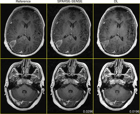 Gopal Nataraj 1 And Ricardo Otazo 1 2