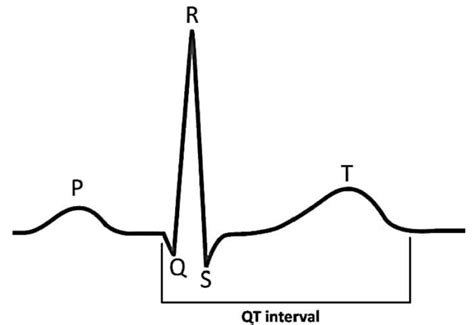 Long QT Syndrome And Anaesthesia WFSA Resources