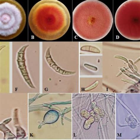 Pdf Morphological And Molecular Characterization Of Fusarium Chlamydosporum F Brachygibbosum