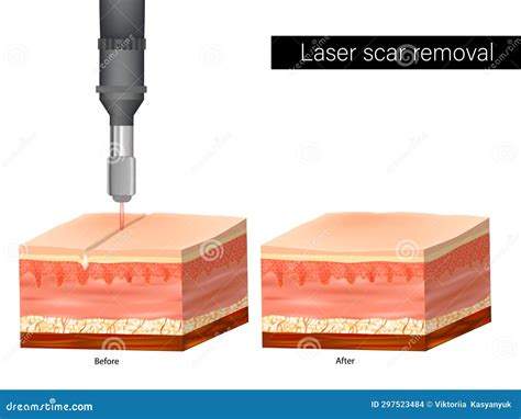 Scar Removal Icon From Plastic Surgery Collection Simple Line Element