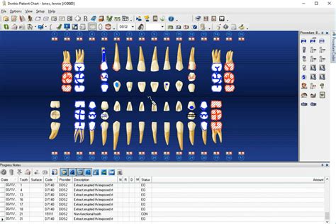 Dental Software Comparison At Marie Renda Blog