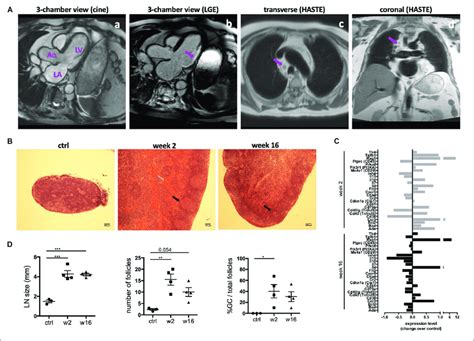 Persistent Activation Of Heart Draining Lymph Nodes At Chf Stage Download Scientific Diagram