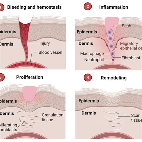Stages Of The Wound Healing Cascade Created By Using