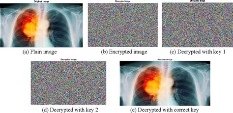 Figure 5 From A Secure Chaotic Framework For Medical Image Encryption
