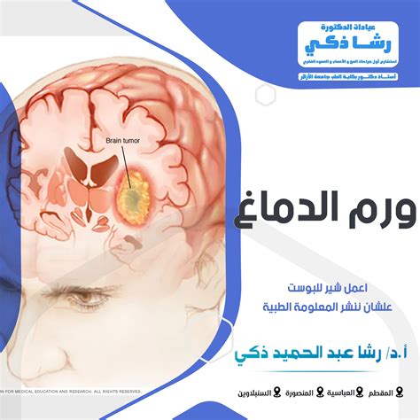 ورم الدماغ هو كتلة أو نمو للخلايا الشاذة في الدماغ وتوجد أنواع مختلفة