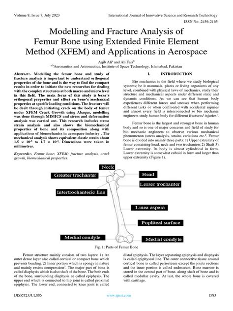 Modelling And Fracture Analysis Of Femur Bone Using Extended Finite