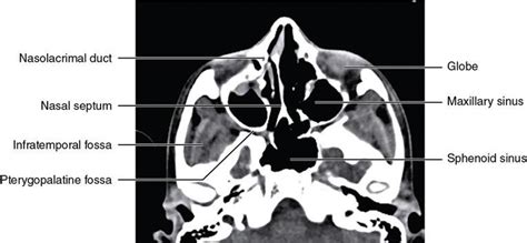 A Orbits Radiology Key
