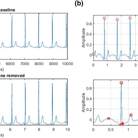 A Electrocardiogram Ecg Signal After Denoising Baseline Wander Download Scientific Diagram