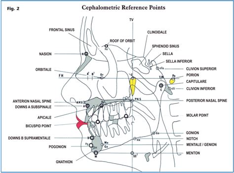 The Bimler Elite Cephalometric Analysis A Valuable Diagnostic Tool For