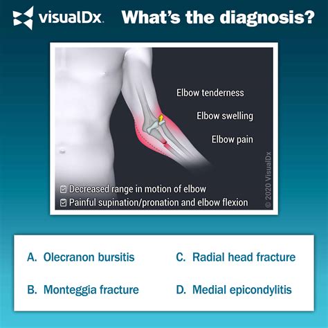 Fractured Radius Elbow Symptoms