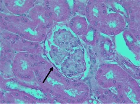 Lab 1 Flashcards Quizlet