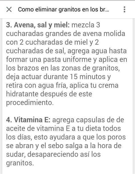 Pin De Diana En Belleza Como Eliminar Granitos Como Quitar Granos