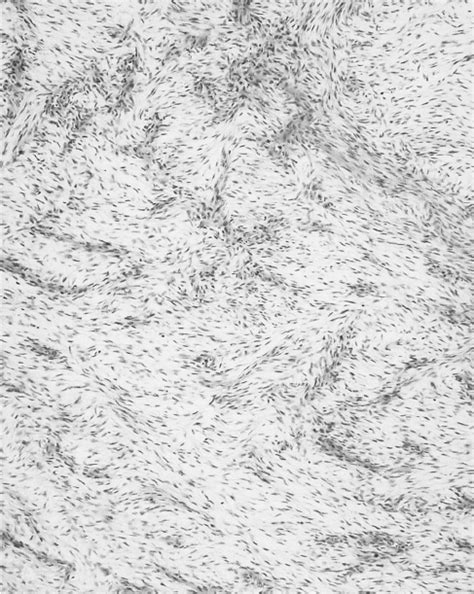 This Low Power Image Of Superficial Lgfms Demonstrates The
