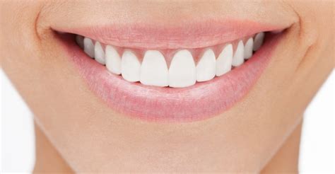 Too Much Fluoride Causes Defects In Tooth Enamel Hale Plus Hearty