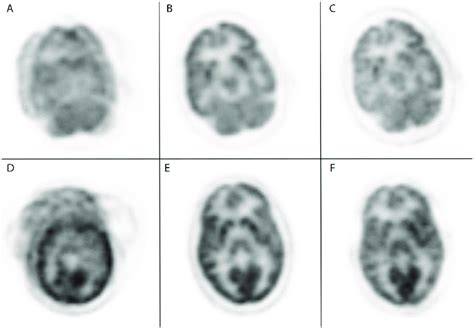 Reconstructed Axial Comparisons Of Uncorrected Data Frame Based