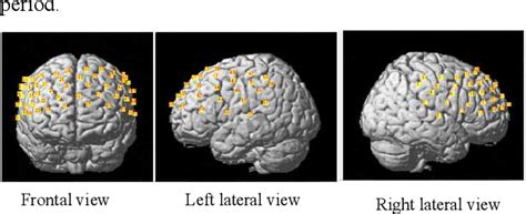 Figure 4 From Evaluation Of Brain Activity By Fnirs During The Process Of Performing The