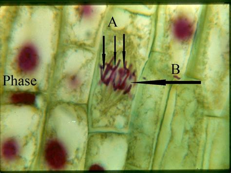 Plant Anaphase Diagram Quizlet